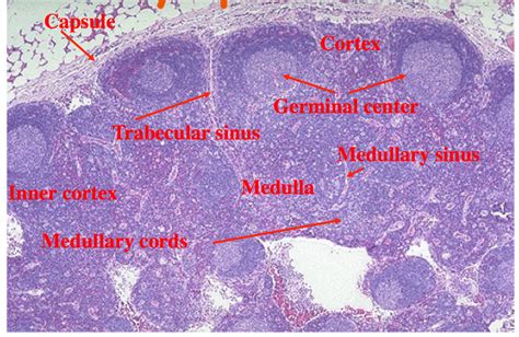 Normal Lymph Node Structure At Robert Bible Blog