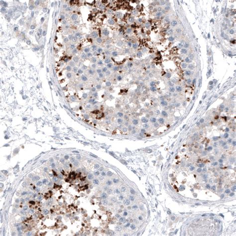 Anti Ct83 Monoclonal Atlas Antibody
