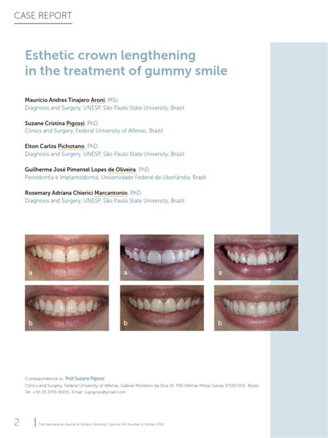 Esthetic Crown Lengthening Pdf Periodontology Dentistry Branches
