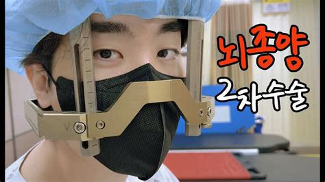 슬폐생 Ep21 폐암 전이성 뇌종양 2번째 감마나이프 수술 후기 30대폐암4기뇌전이뼈전이 Youtube