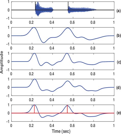 Figure 2 From Automatic Detection Of Hypernasality In Cleft Palate Speech Using Phase Feature