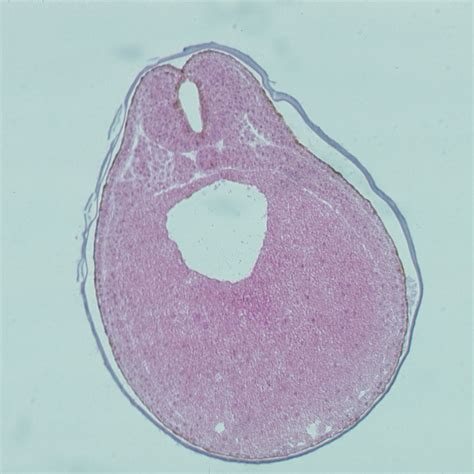 Frog Embryo Neural Tube Microscope Slides Carolina Biological Supply