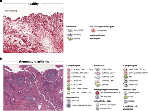 An Updated Compendium Of Synovial Cell Subsets In Ra A Healthy Download Scientific Diagram