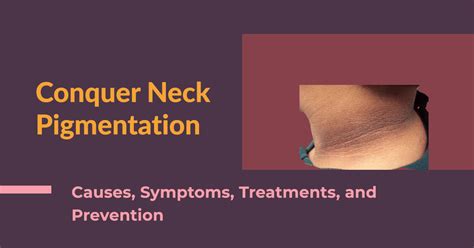 Neck Pigmentation Causes Symptoms Treatments And Prevention