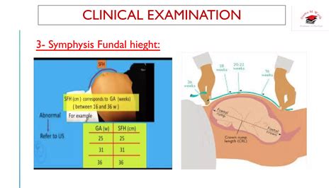 Estimation Of Gestational Age Pdf