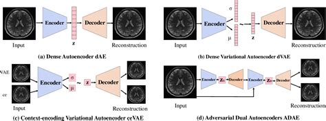 Figure From Brain Tumor Anomaly Detection Via Latent Regularized Adversarial Network