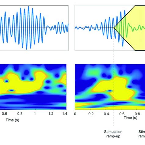 Programming Of Directional Dbs Lead Designs Conventional And Download Scientific Diagram
