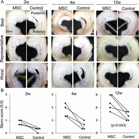 Macroscopic Analysis A Macroscopic Features To Remove Individual