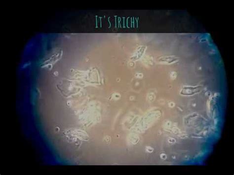 Trichomonas Microscope