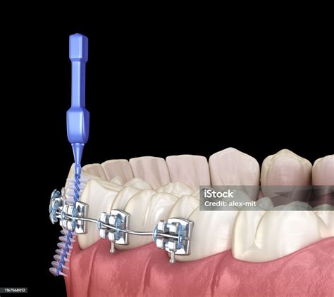 치간 치아 브러시와 중괄호 청소 구강 위생의 의학적으로 정확한 3d 그림 건강관리와 의술에 대한 스톡 사진 및 기타 이미지 건강관리와 의술 디지털 생성 이미지