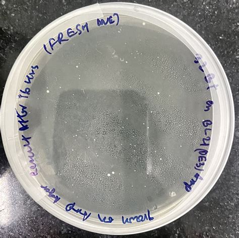 I Am Getting Rna Bands Only In Plasmid Isolation Researchgate