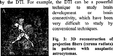 Figure 3 From Data Analysis Techniques And Applications Of Diffusion Tensor Imaging Semantic