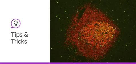 My Staining Didnt Work Part 1 Background Staining In Ihc And If Vectorlabs