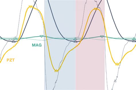 Wearable Respiratory Data During Pulmonary Rehabilitation Exercises