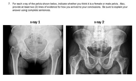 Male Vs Female Pelvis Diagram Quizlet Male Vs Female Pelvis Diagram Quizlet