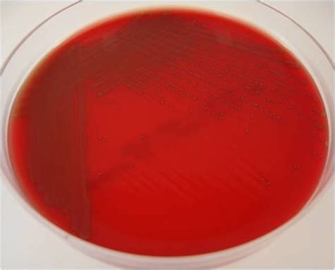 Microbio Flashcards Quizlet