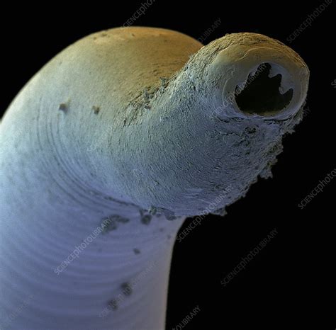 Hookworm Under Microscope