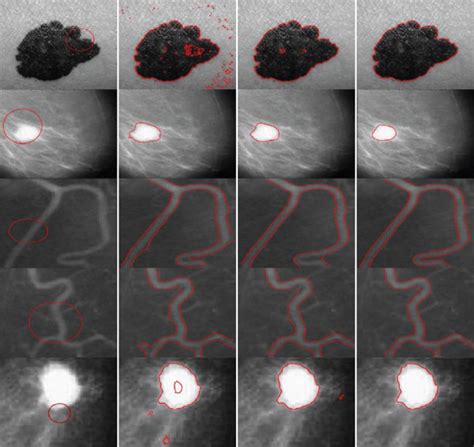 Real Medical Images With Different Inhomogeneous Intensity Levels Download Scientific Diagram