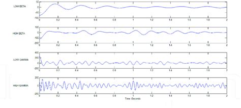 First Plot Shows Original Signal Followed By Segmented EEG Seizure Download Scientific Diagram
