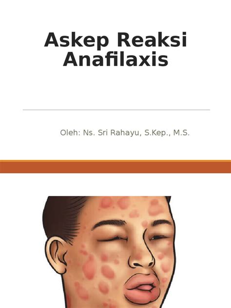 Askep Reaksi Anafilaksis Pdf