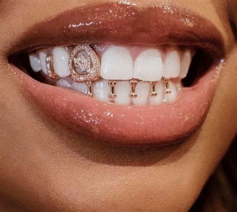 Pin De Dior Laparis En Girly Parrillas Para Los Dientes Dientes