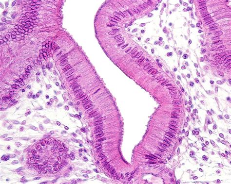 Simple Squamous Epithelium Slide Simple Squamous Epithelium Slide