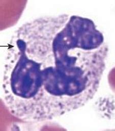 Topic Sex Determination And Sex Linked Characteristics Flashcards Quizlet