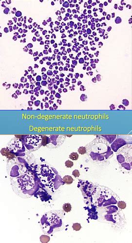 Lecture 2 Lesion Classification Flashcards Quizlet