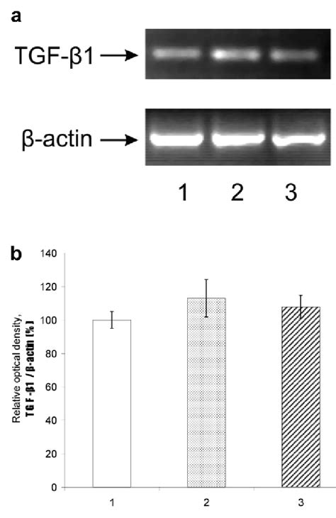 A Rt Pcr Analysis Of Tgf β1 Mrna Expression In Vein Walls Lane