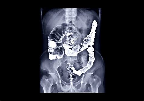 Improving Safety In Contrast Media Use