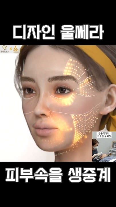 디자인울쎄라 리프팅 생중계해드려요🥰 Youtube