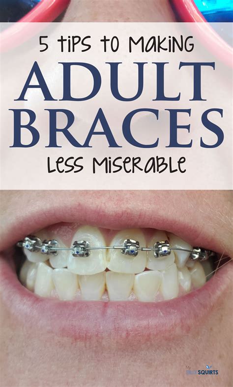 Adult Braces Here S Five Easy Tips To Making Them Less Miserable My Silly Squirts