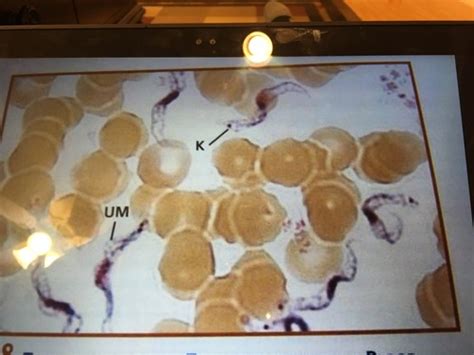 Microbio Lab Practical Summary Flashcards Quizlet