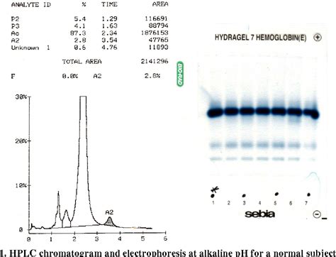 Detection Of Abnormal Hemoglobin Variants By Hplc Method 54 Off