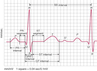 Bio Medical Engineering Solutions SL QRS Complex ST Interval