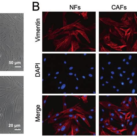 Characteristics Of Fibroblasts Derived From Patients With Pc A Download Scientific Diagram