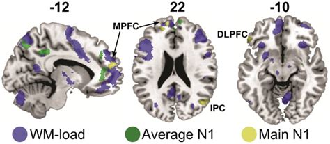 Activation Patterns Resulted From A Random Effects Glm Including