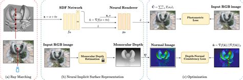 neural implicit surface reconstruction of freehand 3d ultrasound volume with geometric