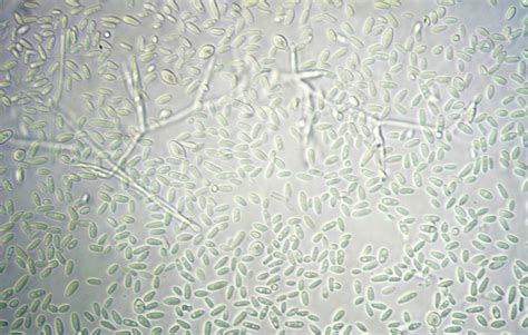 Any Ideas Regarding Reducing Contamination During Isolation Of