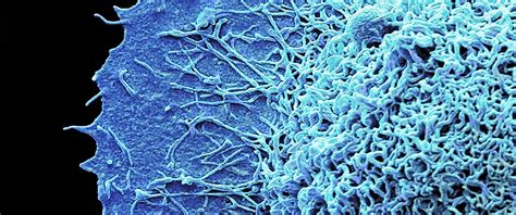 The Microbial Metabolic Nexus In Colon Cancer Content For Health