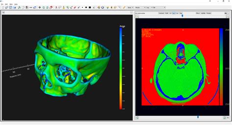 3d Model Of Head From Ct Scan With Curvature Mapping 1024×555 Qmetrics Technologies