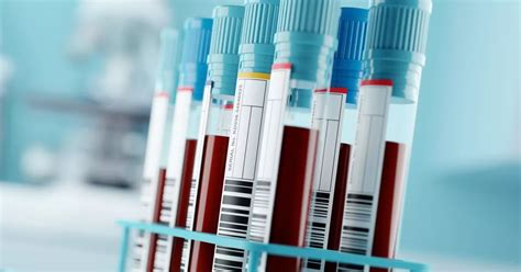 Circulating Tumor Dna Testing Ctdna Could Transform The Management Of