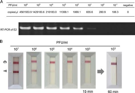 Typical Banding Profile Of The Rapid Diagnostic Test For Chikungunya Download Scientific