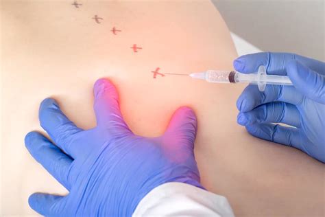 Trigger Point Injections Innovation Medical