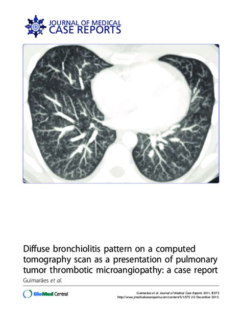 Pdf Diffuse Bronchiolitis Pattern On A Computed Tomography Scan As A