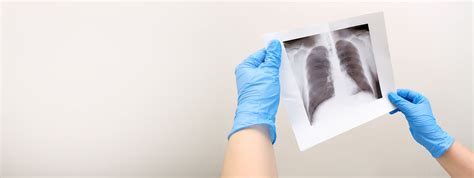 Pulmonary Function Test RxDx Clinics