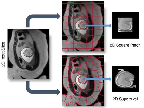 An Illustrative Figure Showing Both Square Patches And Superpixels