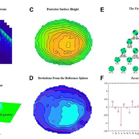 The Zernike Coefficient Analysis Process Of The Posterior Surface Of Download Scientific