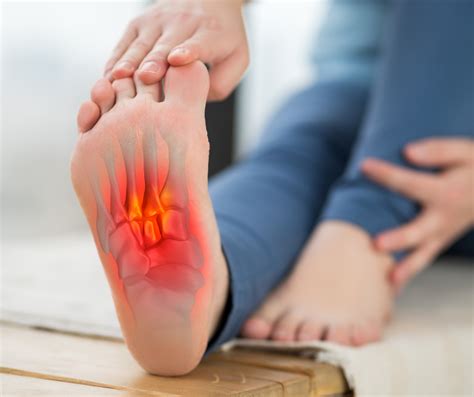 4 Real Life Examples Of Plantar Fasciitis My Chicago Foot Expert
