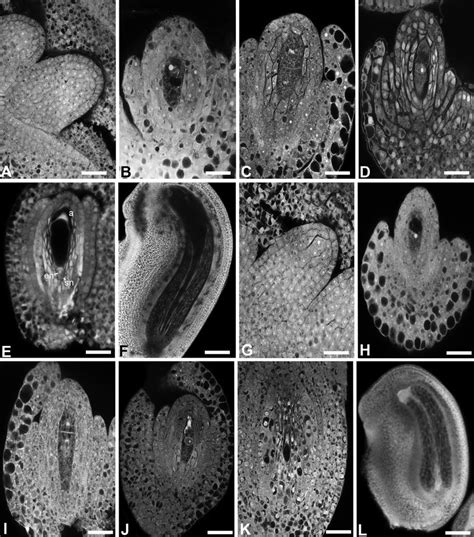 Confocal Scanning Laser Microscope Clearings Of Soybean Wild Type Wt Download Scientific